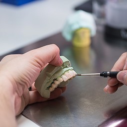 Mojo Dental Laboratory | Dental Implant Systems | Dental Implants